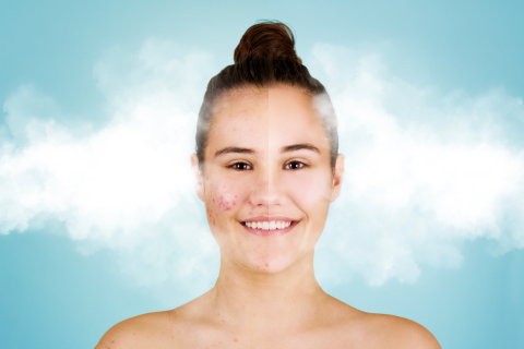 Cryo-Facial "Frotox" | Cryo Reload, LLC | Brownsville, TX.
