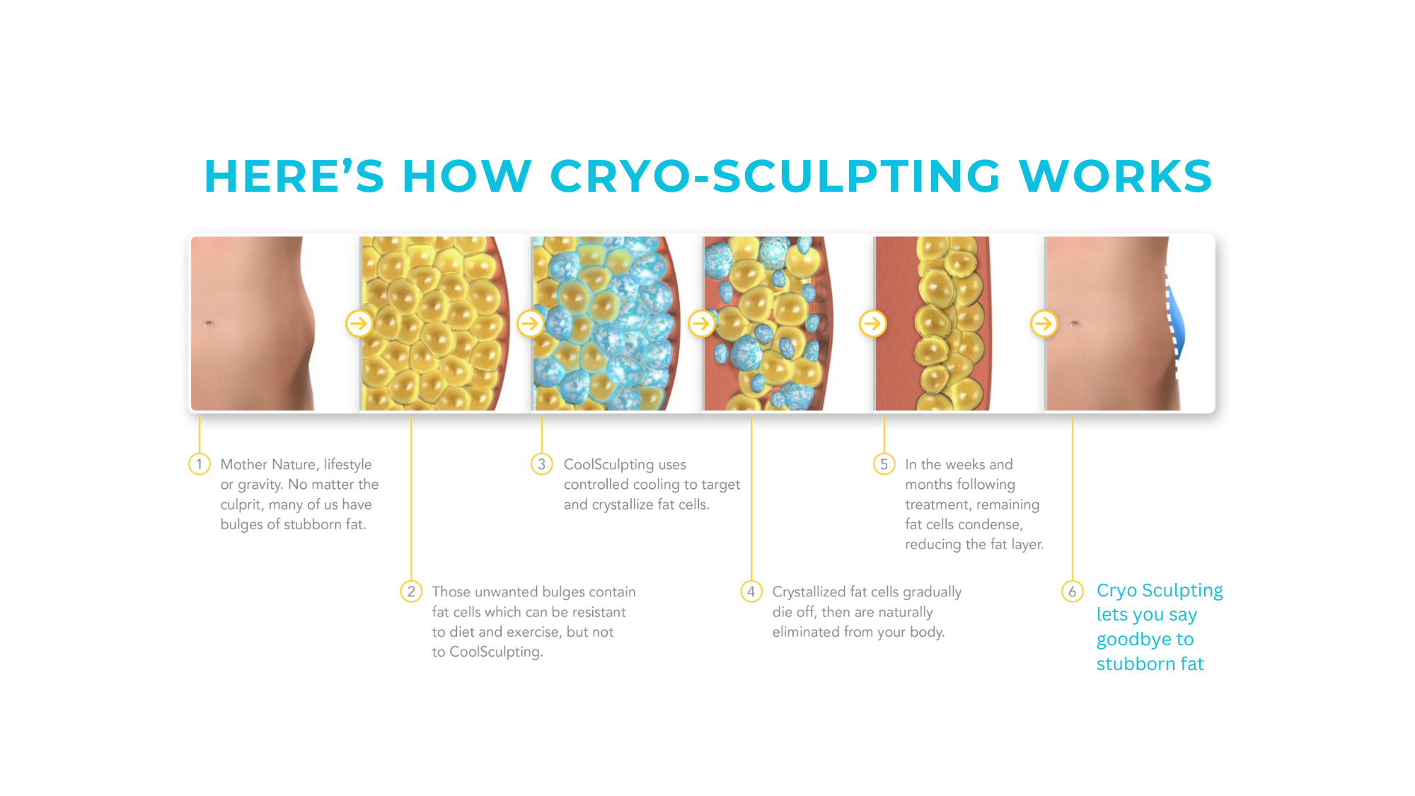 Cryo-Sculpting | Cryo Reload, LLC | Brownsville, TX.